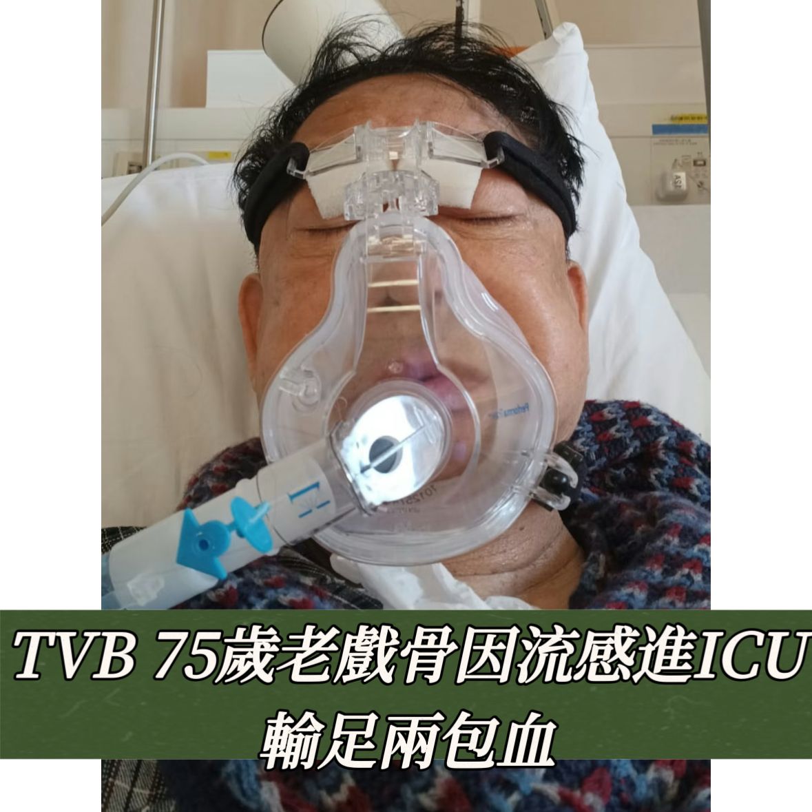 TVB 75歲老戲骨因流感進ICU，輸足兩包血 - MyBB