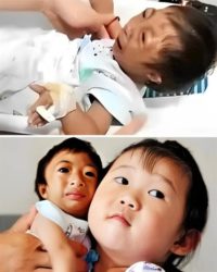 16年前，這對夫婦生下「小猴子」，差點被雜技團買走，如今怎樣了 - MyBB