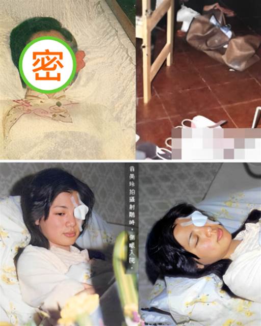 翁美玲：26歲離世之后，為何身包五層錫紙，法醫說出驚人內幕，死亡細節曝光 - MyBB